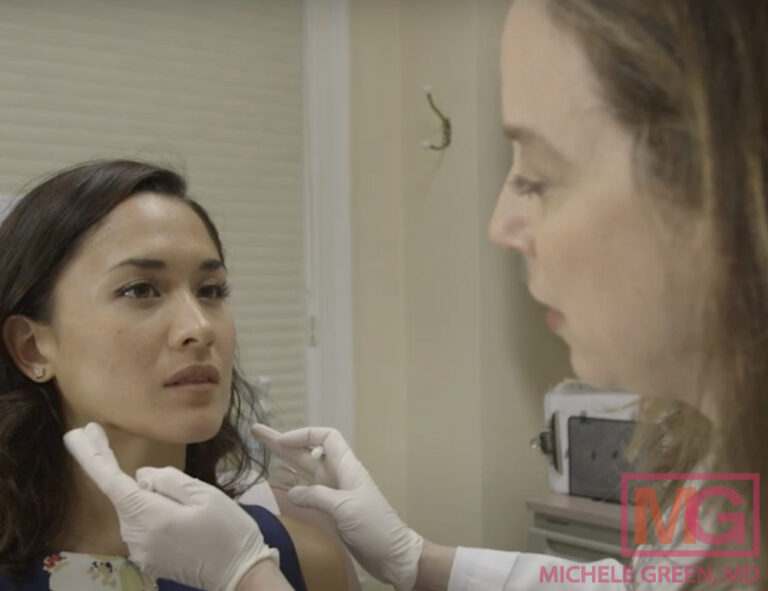 Face Slimming Botox, Botox for Facial Slimming - Dr. Michele Green M.D.