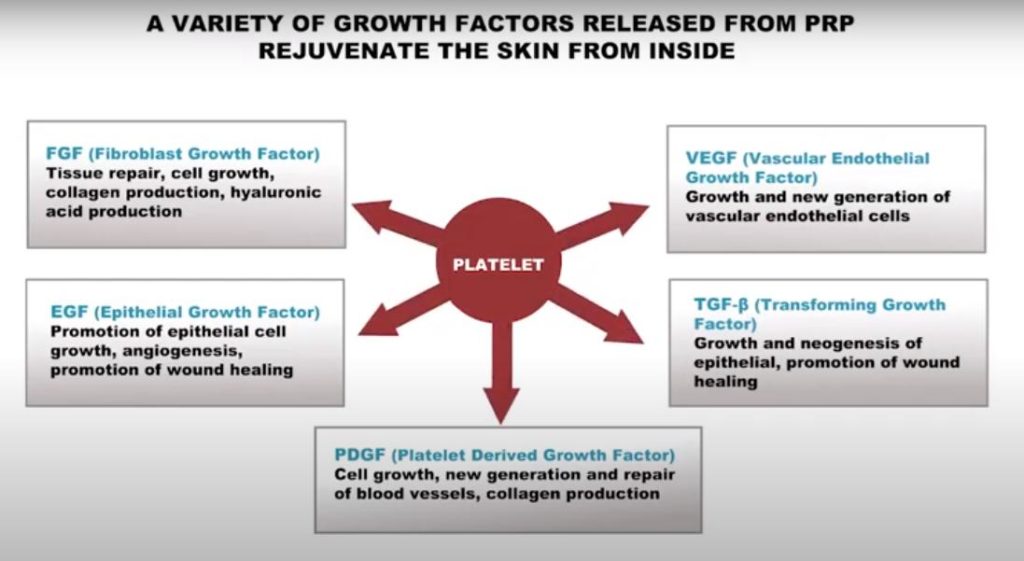 Microneedling PRP, Platelet Rich Plasma with Microneedling