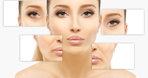 Botox vs. Restylane, Compare Hyaluronic Acid Fillers - Dr. Michele ...