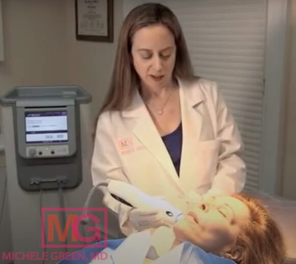 How Much Does Thermage Skin Tightening Cost? - Dr. Michele Green M.D.