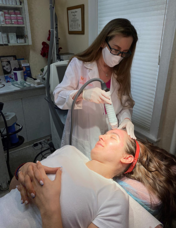 Vivace Microneedling, RF Microneedling Treatments NYC